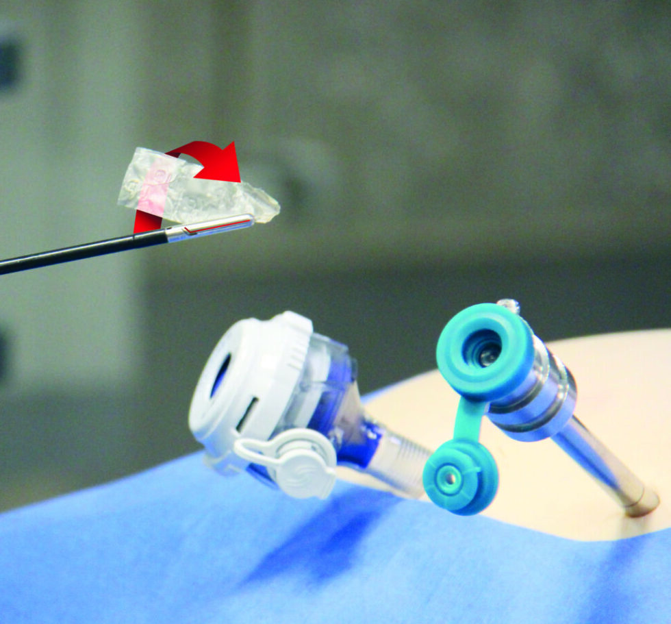 Orthopedic Surgery | MIMEDX