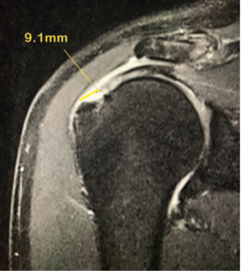 Orthopedic Surgery | MIMEDX