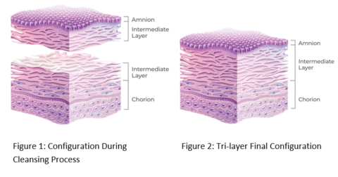 AMNIOEFFECT | MIMEDX