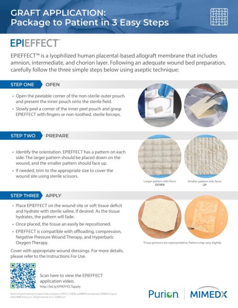 EPIEFFECT | MIMEDX